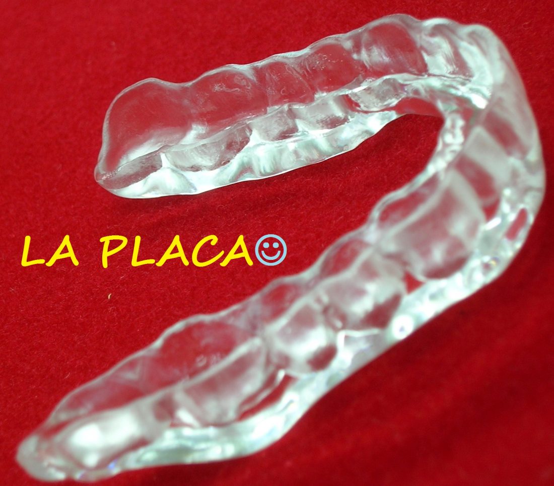 Placa de bruxismo o miorrelajante - juanbalboa.com
